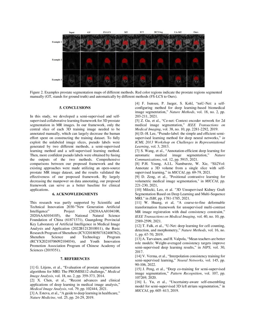 Semi Supervised And Self Supervised Collaborative Learning For Prostate 3d Mr Image Segmentation
