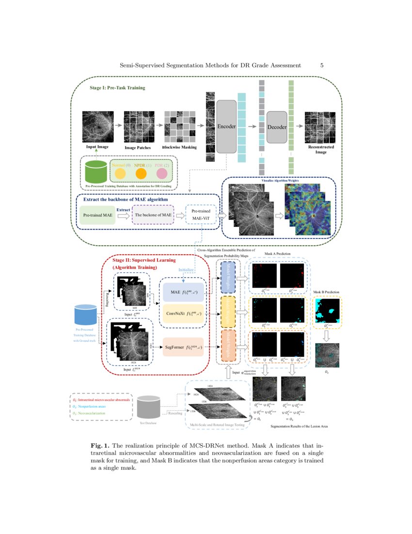 Semi-Supervised Semantic Segmentation Methods for UW-OCTA Diabetic Retinopathy Grade Assessment ...