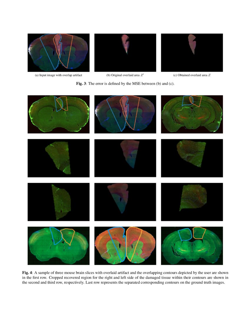 Separating Overlapping Tissue Layers from Microscopy Images | DeepAI