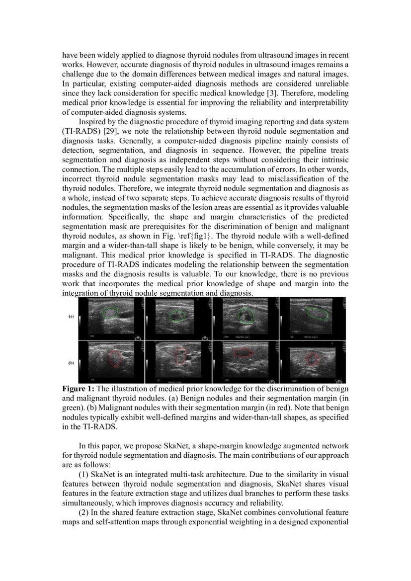 Shape Margin Knowledge Augmented Network For Thyroid Nodule Segmentation And Diagnosis Deepai