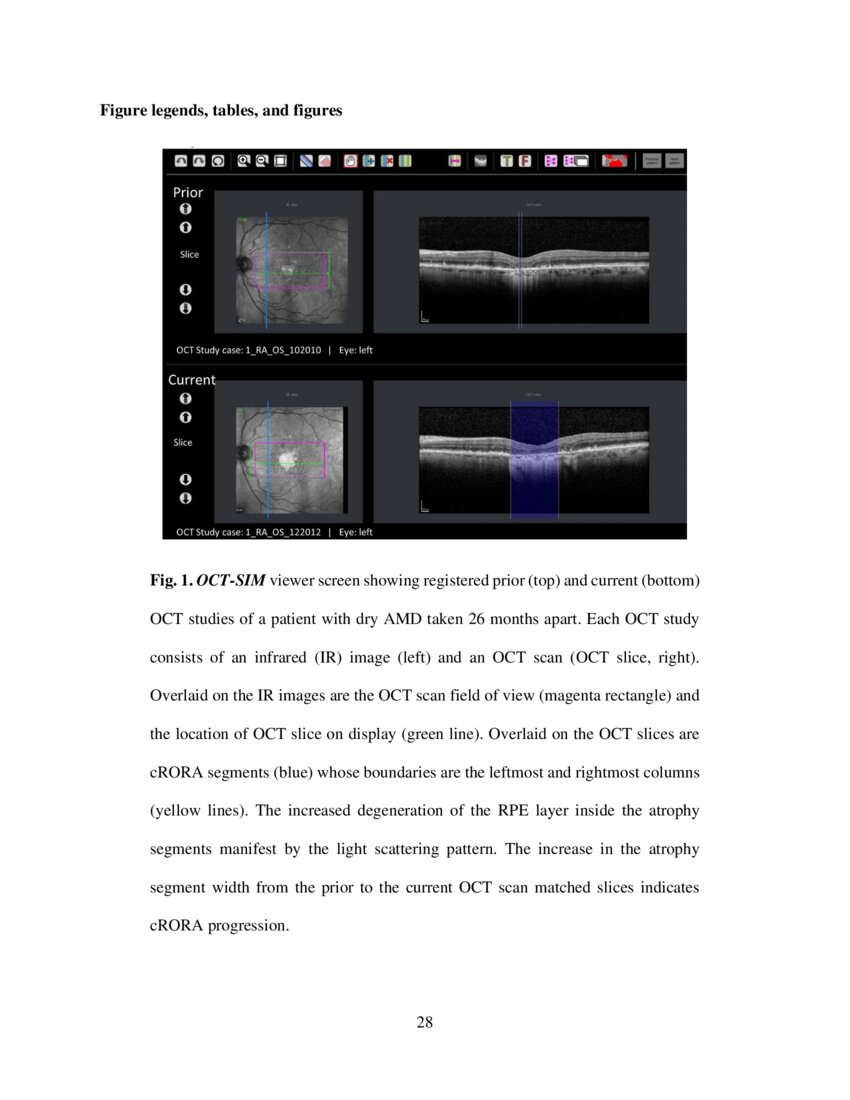 Simultaneous column-based deep learning progression analysis of atrophy associated with AMD in ...