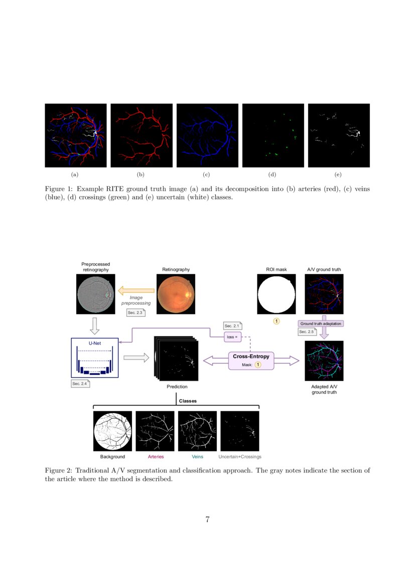 Simultaneous Segmentation And Classification Of The Retinal Arteries And Veins From Color Fundus