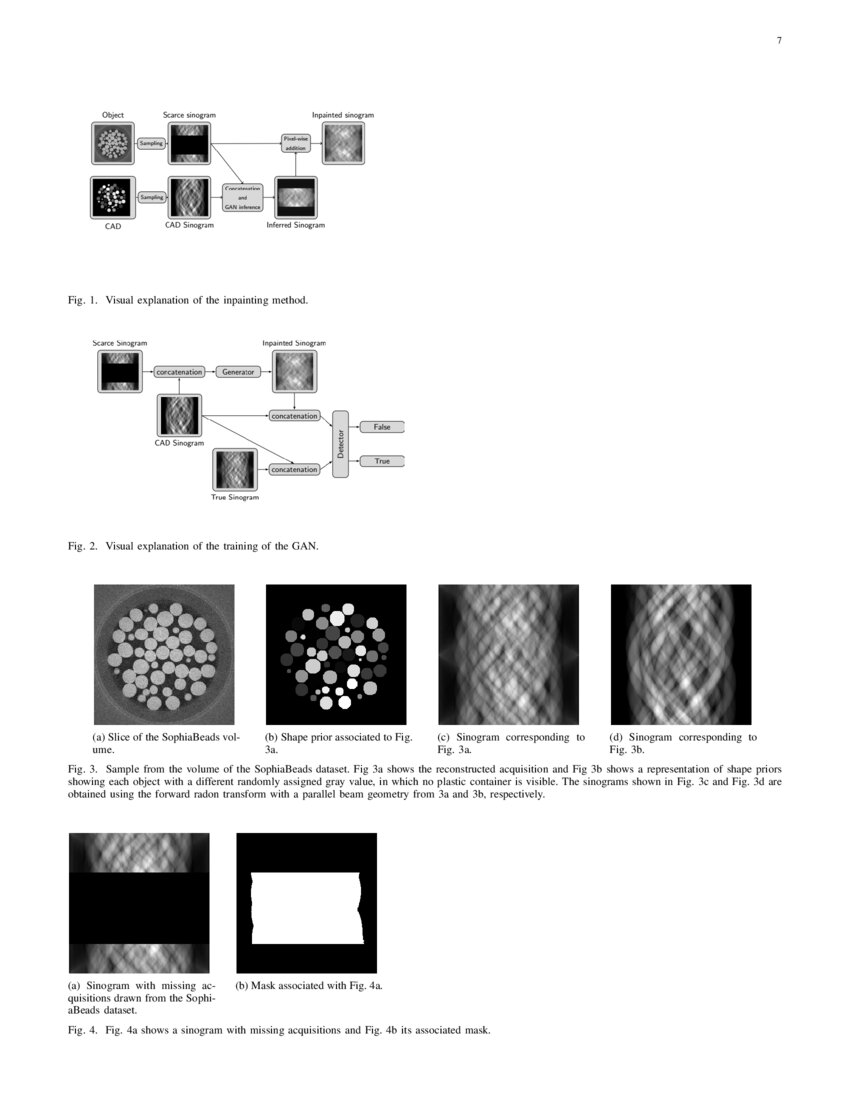Sinogram Enhancement with Generative Adversarial Networks using Shape Priors | DeepAI