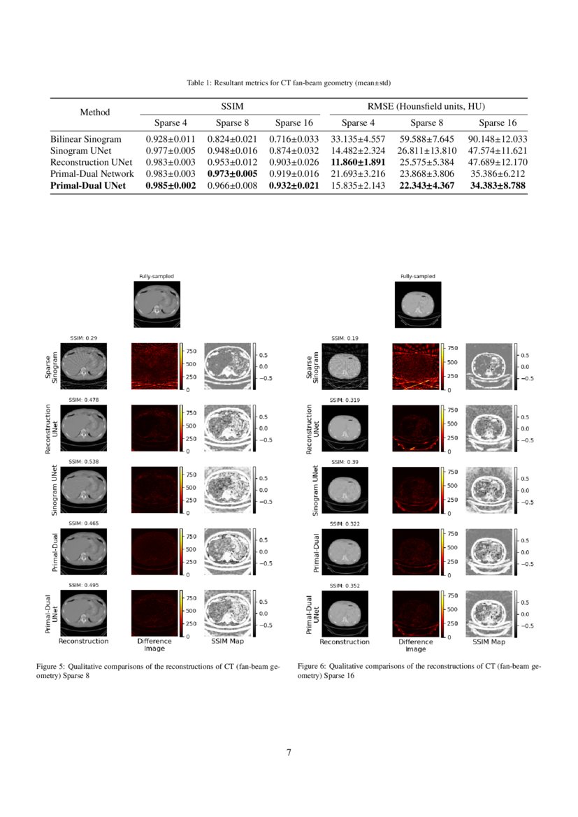 Sinogram upsampling using Primal-Dual UNet for undersampled CT and ...
