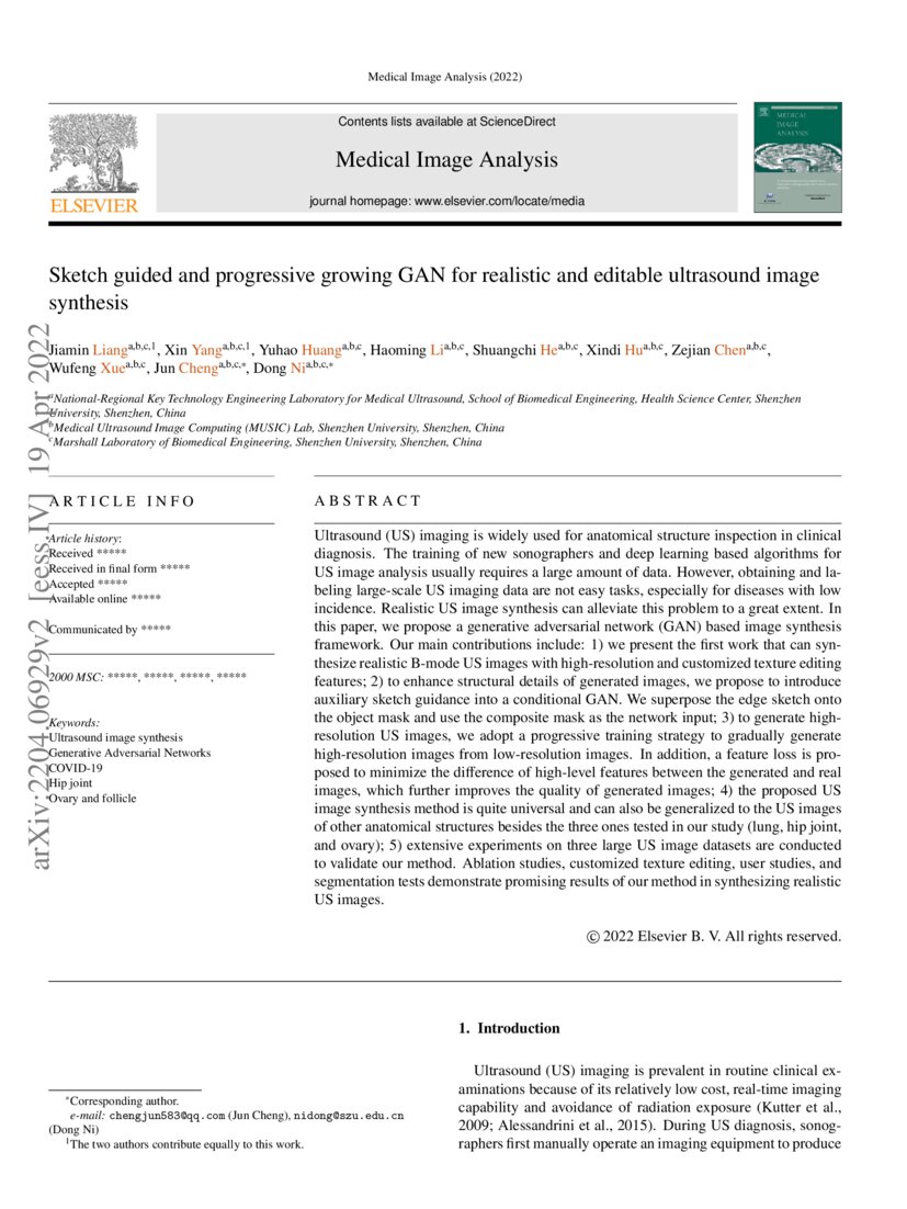 Sketch guided and progressive growing GAN for realistic and editable ultrasound image synthesis ...