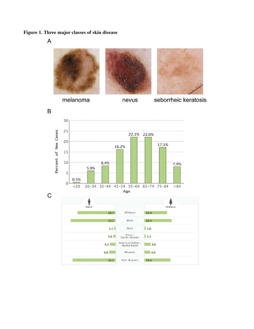 Skin cancer reorganization and classification with deep neural network ...