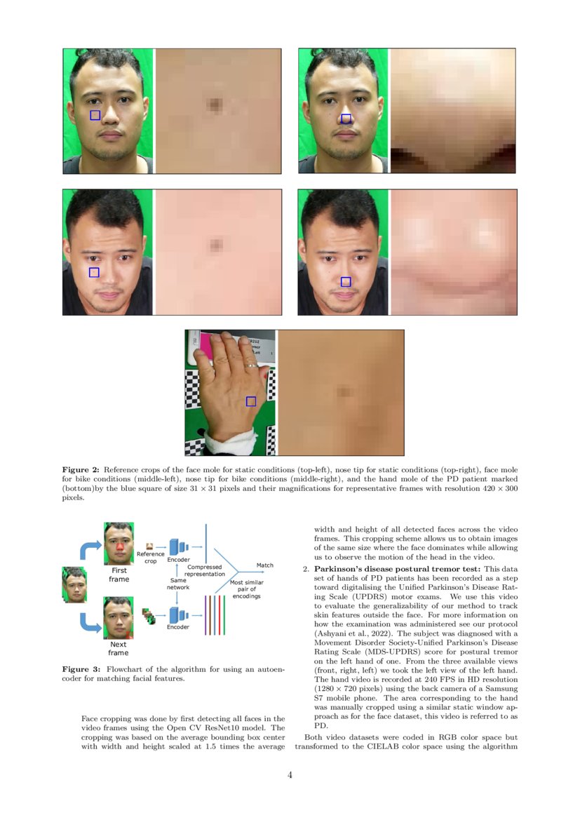 Skin feature point tracking using deep feature encodings | DeepAI