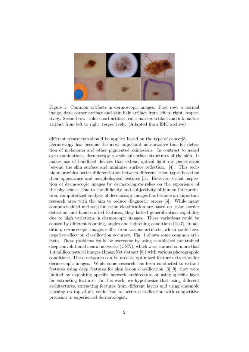 Skin Lesion Classification Using Hybrid Deep Neural Networks Deepai