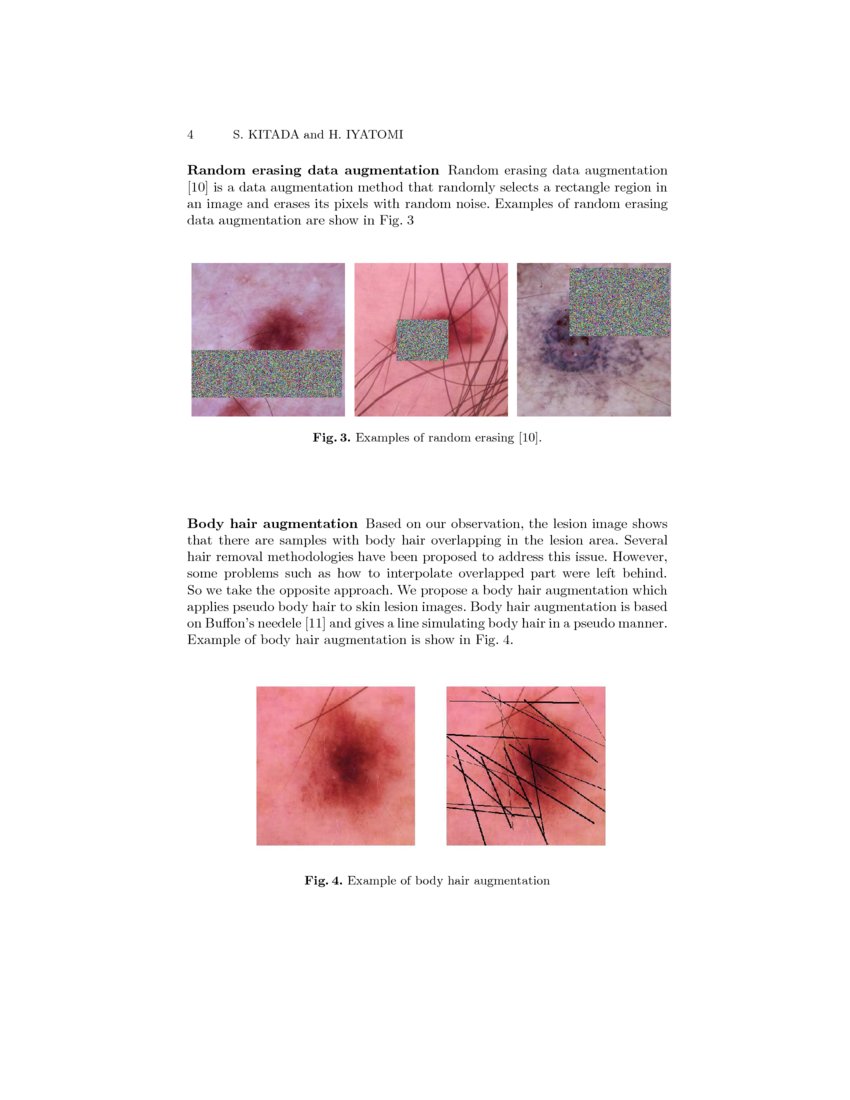 Skin lesion classification with ensemble of squeeze-and-excitation ...