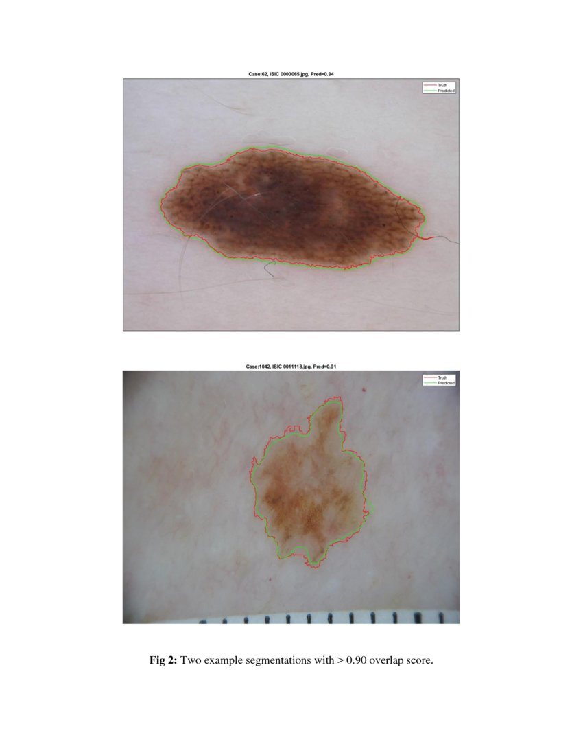 Skin Lesion Segmentation And Classification For Isic 2018 Using