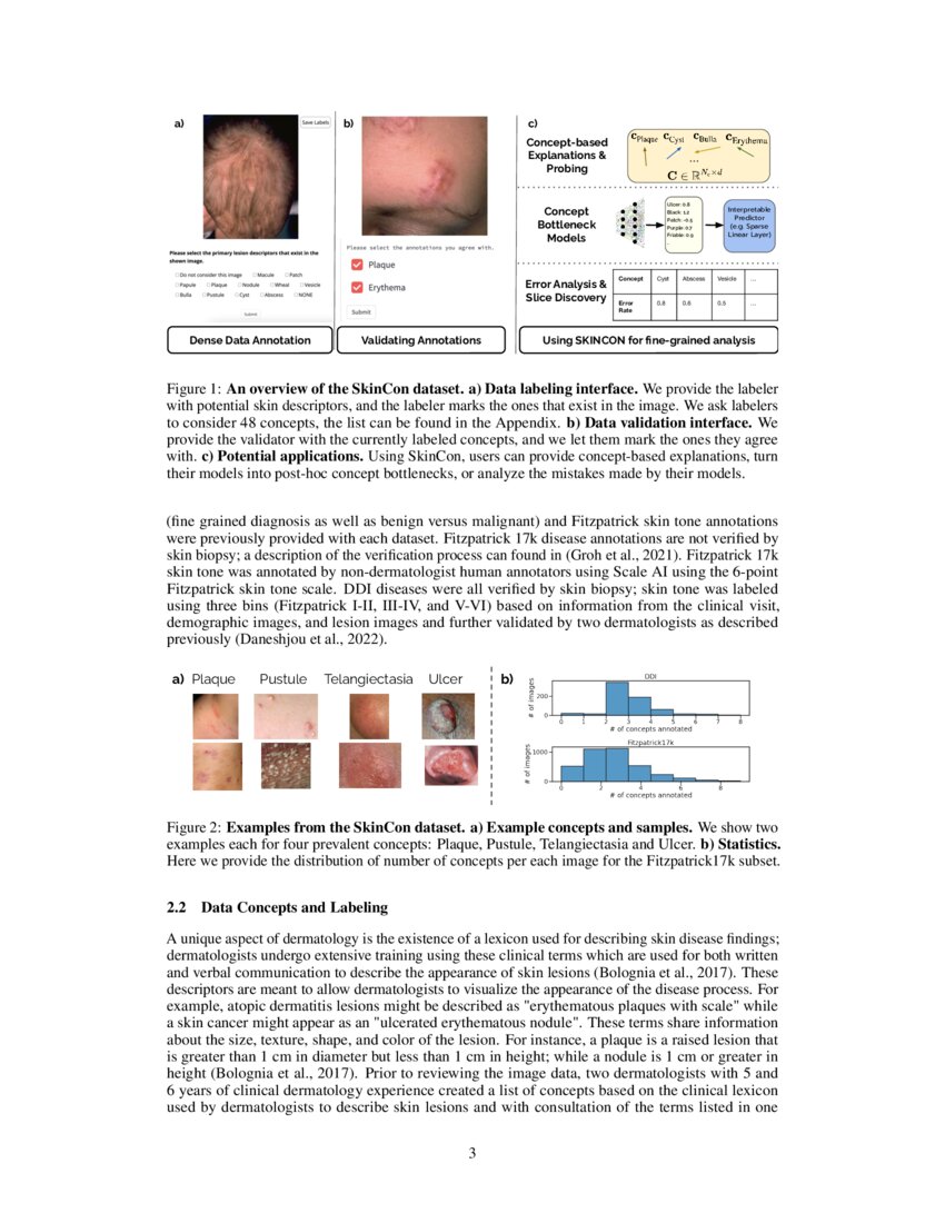 SkinCon: A skin disease dataset densely annotated by domain experts for ...