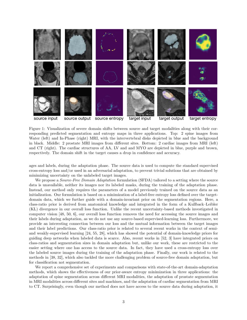 Source-Free Domain Adaptation for Image Segmentation | DeepAI
