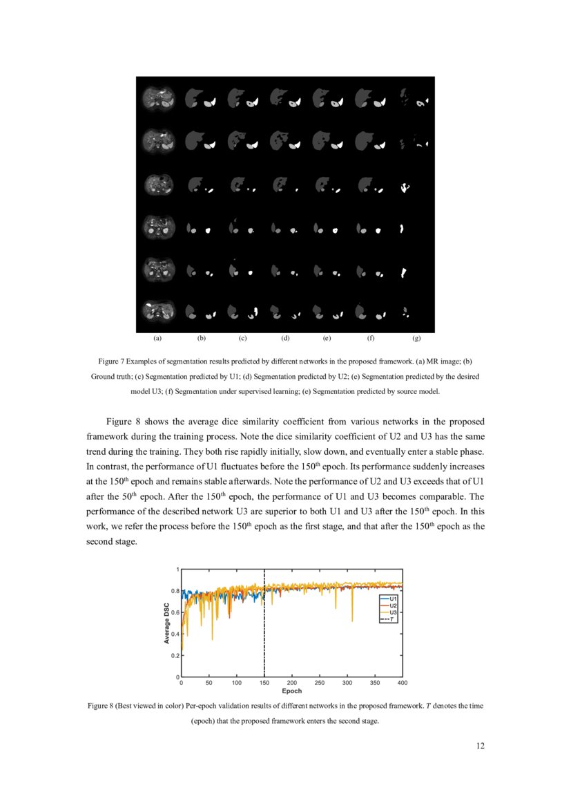 Source Free Unsupervised Domain Adaptation For Cross Modality Abdominal Multi Organ Segmentation