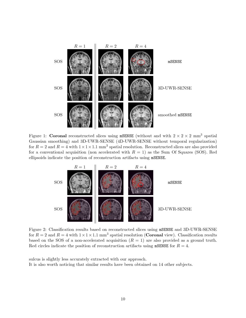 Spatio Temporal Wavelet Regularization For Parallel Mri Reconstruction Application To 8587