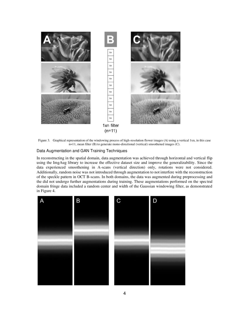 Spectral Bandwidth Recovery Of Optical Coherence Tomography Images Using Deep Learning Deepai