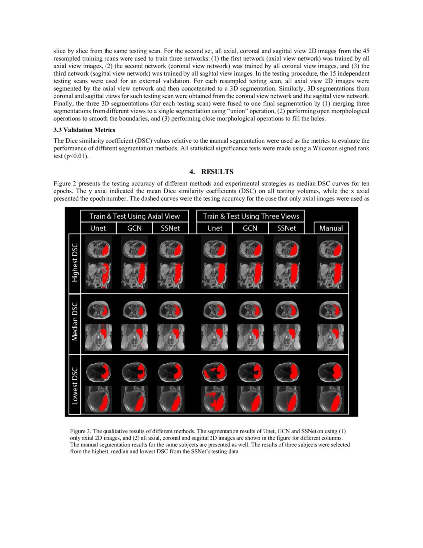 Splenomegaly Segmentation Using Global Convolutional Kernels And Conditional Generative