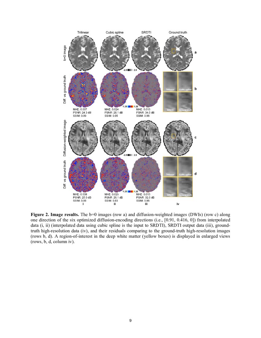 Srdti Deep Learning Based Super Resolution For Diffusion Tensor Mri Deepai