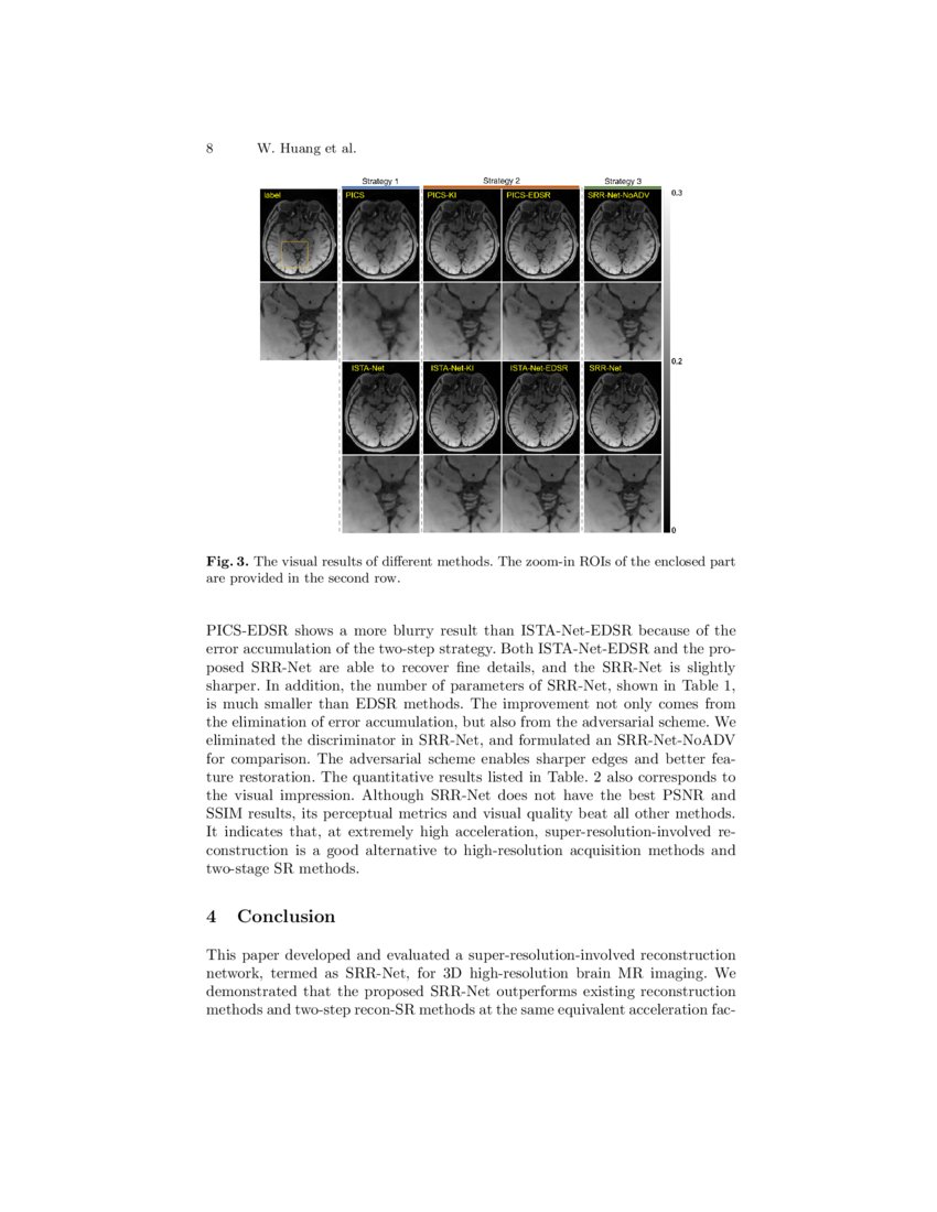 Srr Net A Super Resolution Involved Reconstruction Method For High Resolution Mr Imaging Deepai