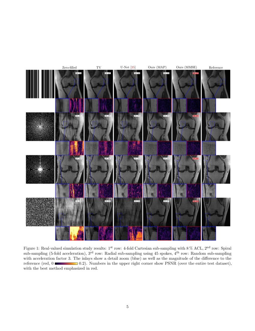 Stable deep MRI reconstruction using Generative Priors | DeepAI