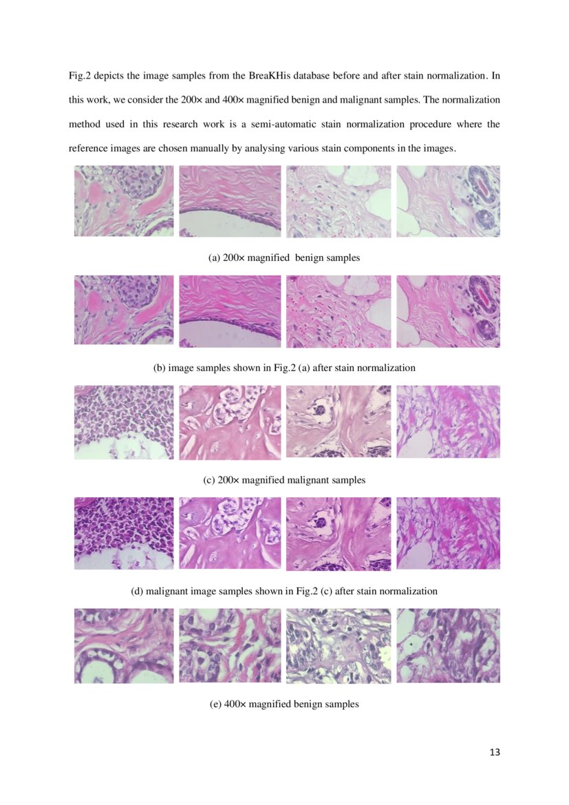 Stain Normalized Breast Histopathology Image Recognition using Convolutional Neural Networks for ...