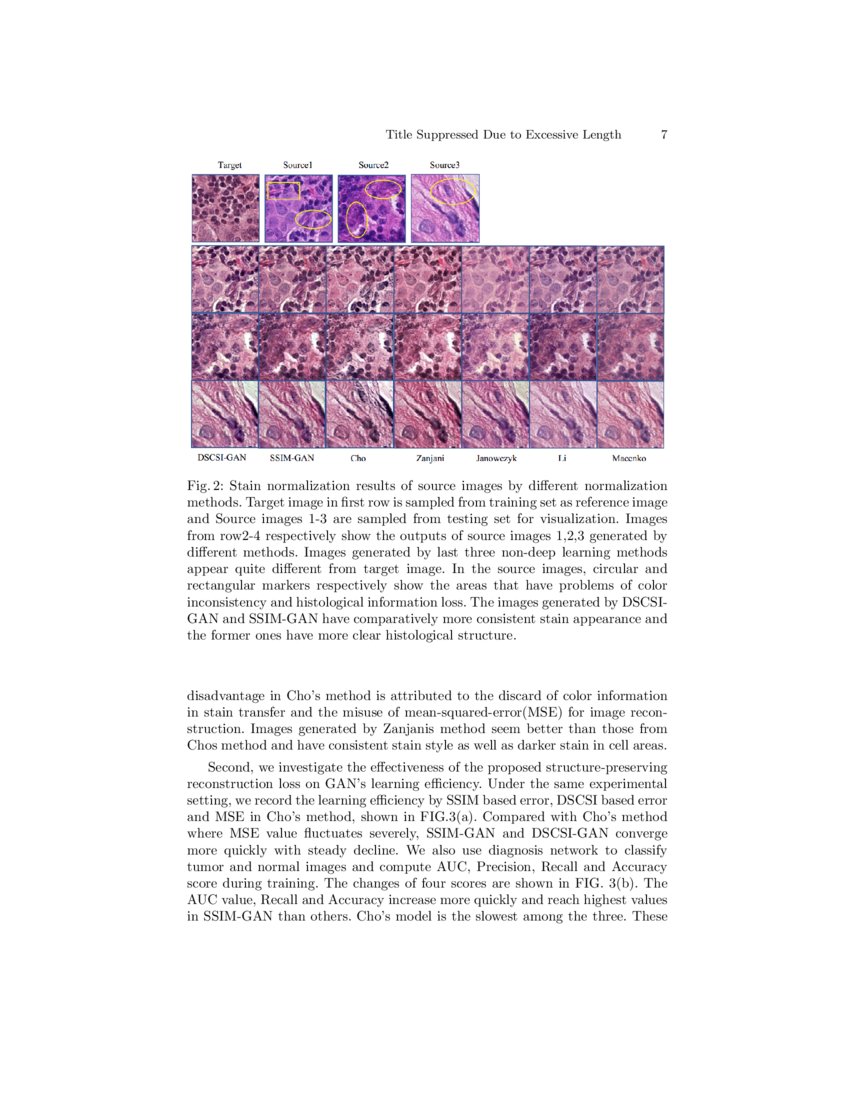 Stain Style Transfer of Histopathology Images Via Structure-Preserved ...