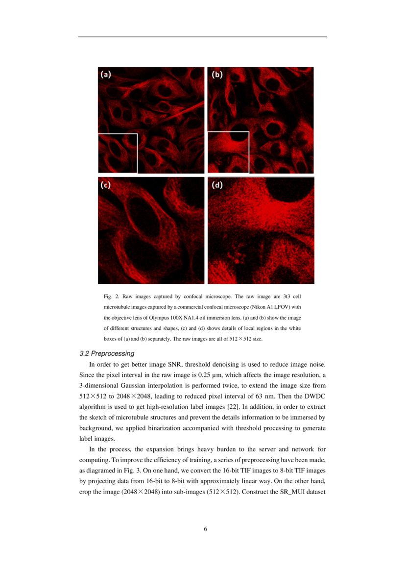 Super Resolution Reconstruction Of Cytoskeleton Image Based On A Net
