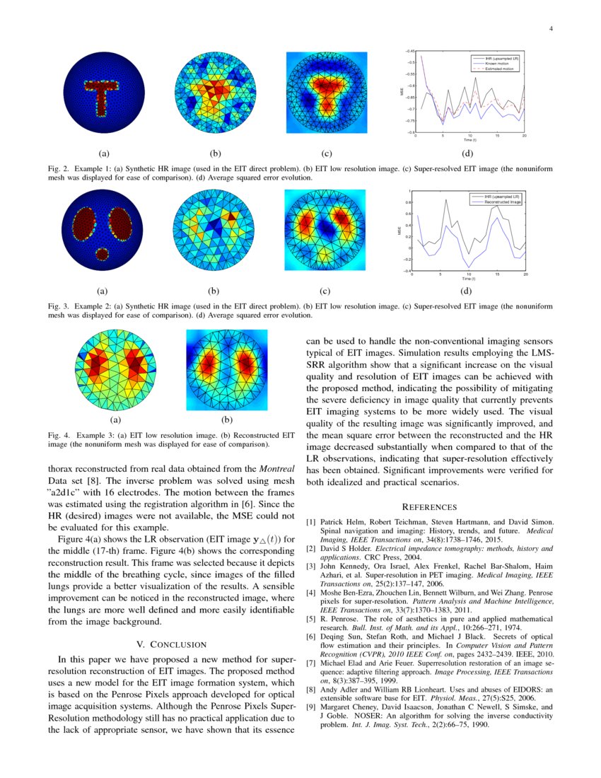 Super-Resolution Reconstruction of Electrical Impedance Tomography ...