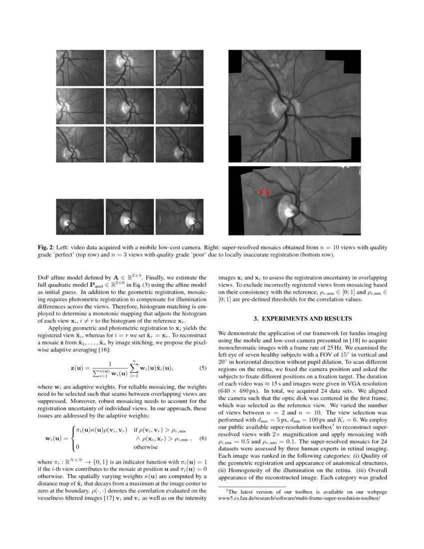 Super-Resolved Retinal Image Mosaicing | DeepAI