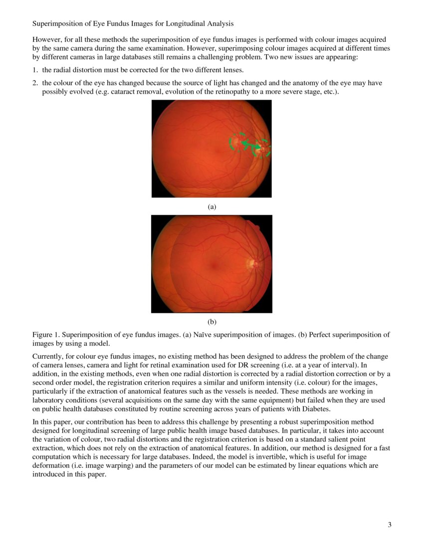 Superimposition of eye fundus images for longitudinal analysis from ...