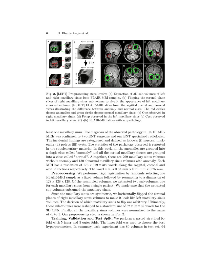 Supervised Contrastive Learning to Classify Paranasal Anomalies in the Maxillary Sinus | DeepAI