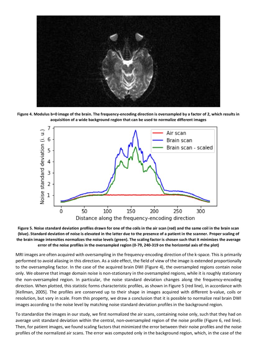 Supervised Denoising of Diffusion-Weighted Magnetic Resonance Images Using a Convolutional ...