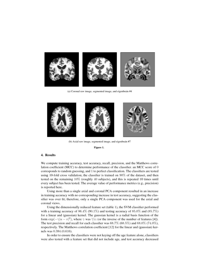 Support vector machine classification of dimensionally reduced structural MRI images for ...