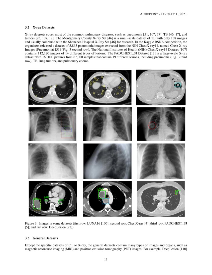 Survey of the Detection and Classification of Pulmonary Lesions via CT ...