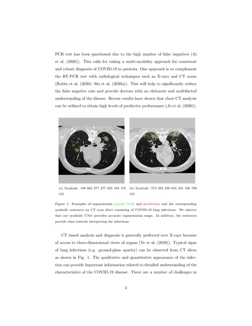 Symbolic Semantic Segmentation and Interpretation of COVID-19 Lung Infections in Chest CT ...