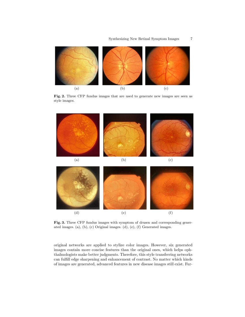 Synthesizing New Retinal Symptom Images by Multiple Generative Models | DeepAI