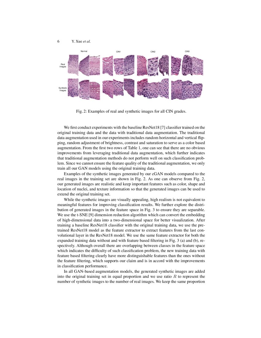 Synthetic Augmentation And Feature Based Filtering For Improved Cervical Histopathology Image