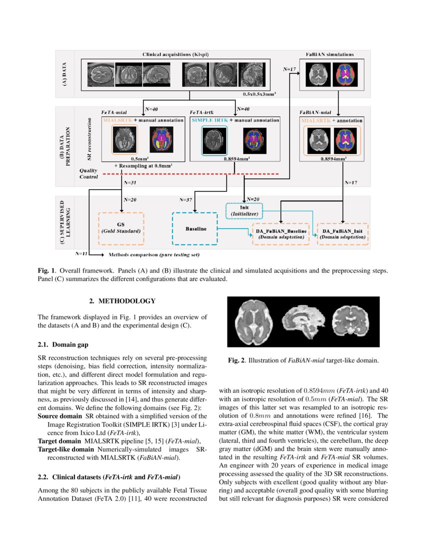 Synthetic magnetic resonance images for domain adaptation: Application to fetal brain tissue ...