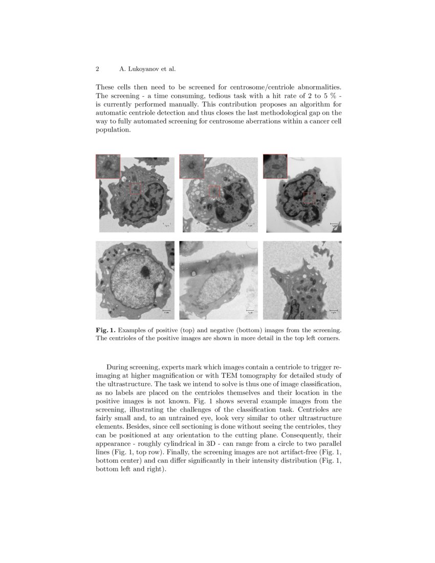 Synthetic patches, real images: screening for centrosome aberrations in ...