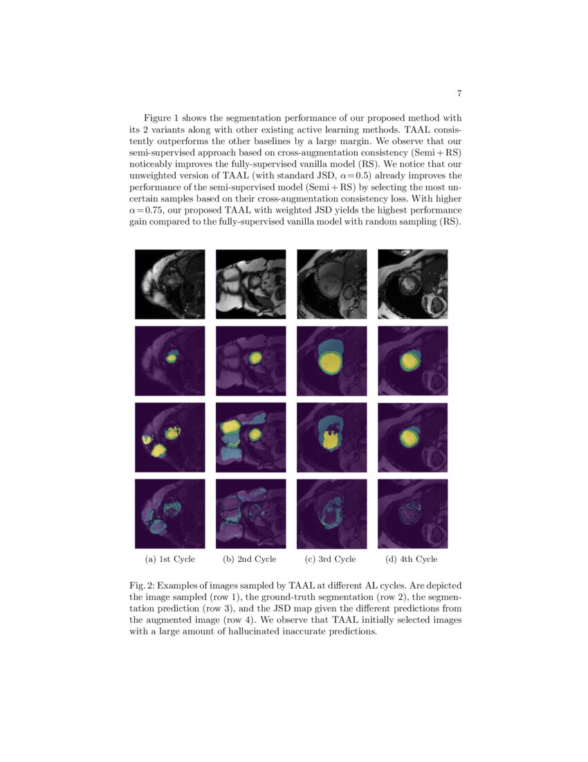 Taal Test Time Augmentation For Active Learning In Medical Image Segmentation Deepai
