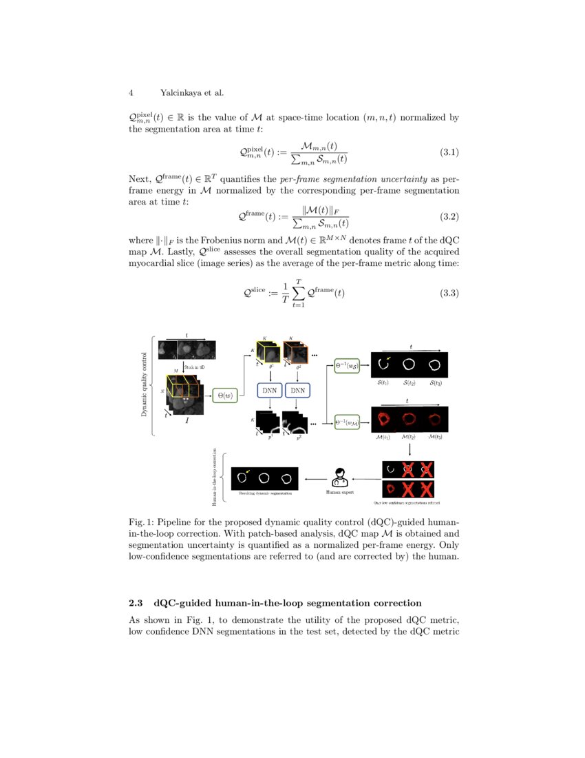 Temporal Uncertainty Localization to Enable Human-in-the-loop Analysis of Dynamic Contrast ...