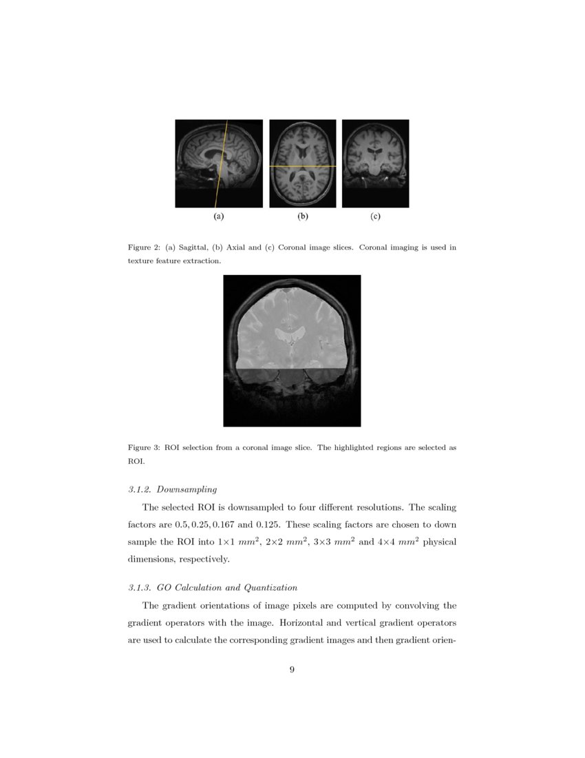Texture Classification of MR Images of the Brain in ALS using CoHOG ...