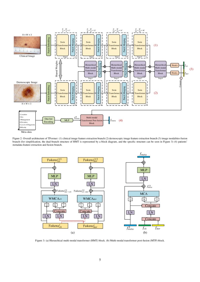 TFormer: A throughout fusion transformer for multi-modal skin lesion ...