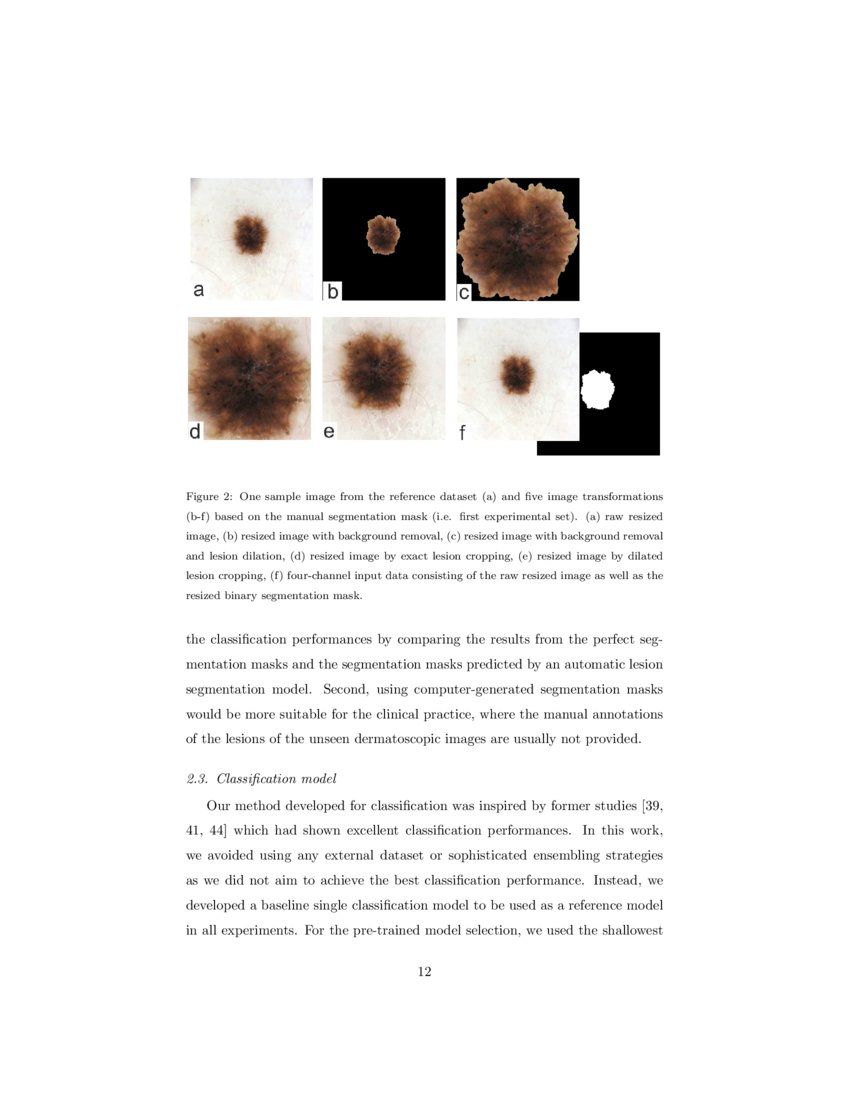 The Effects Of Skin Lesion Segmentation On The Performance Of