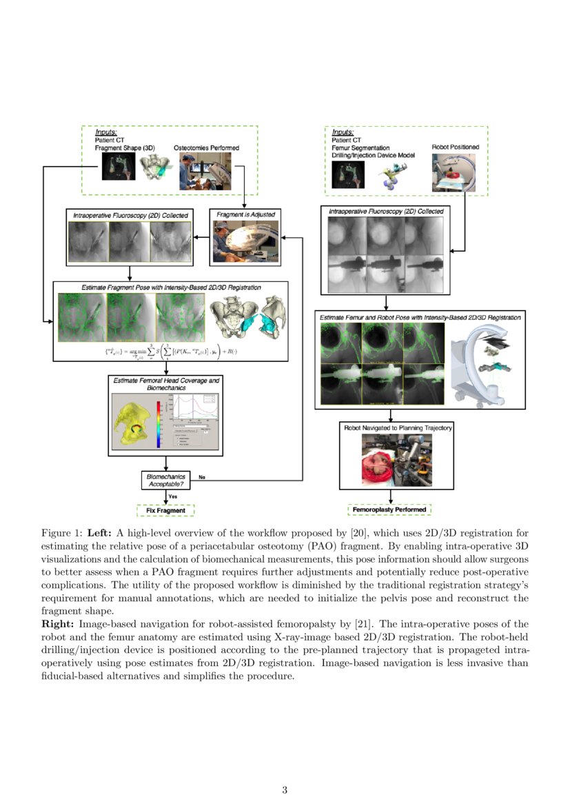 The Impact Of Machine Learning On 2d 3d Registration For Image Guided