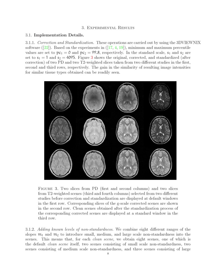 The Influence of Intensity Standardization on Medical Image ...