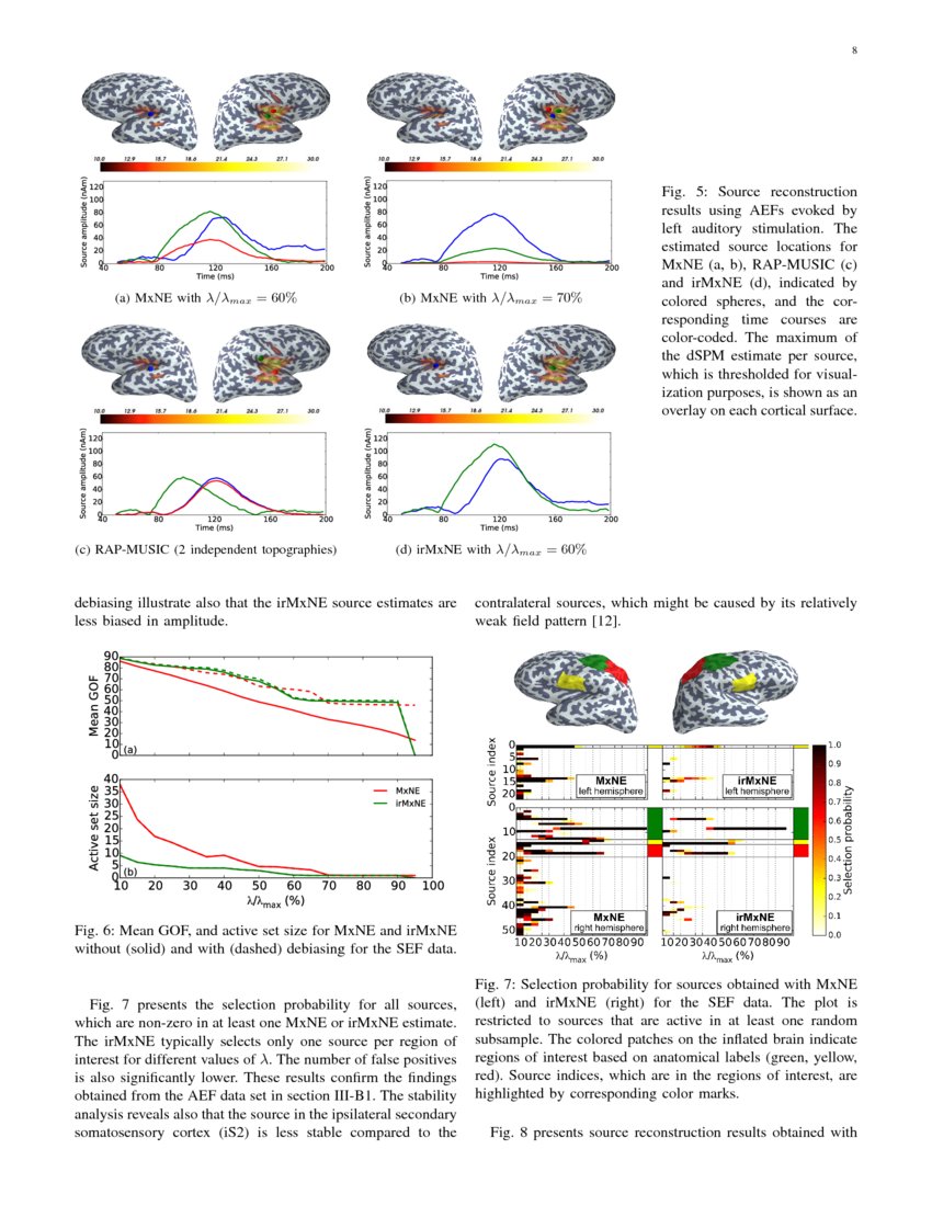 The Iterative Reweighted Mixed Norm Estimate For Spatio Temporal Meg