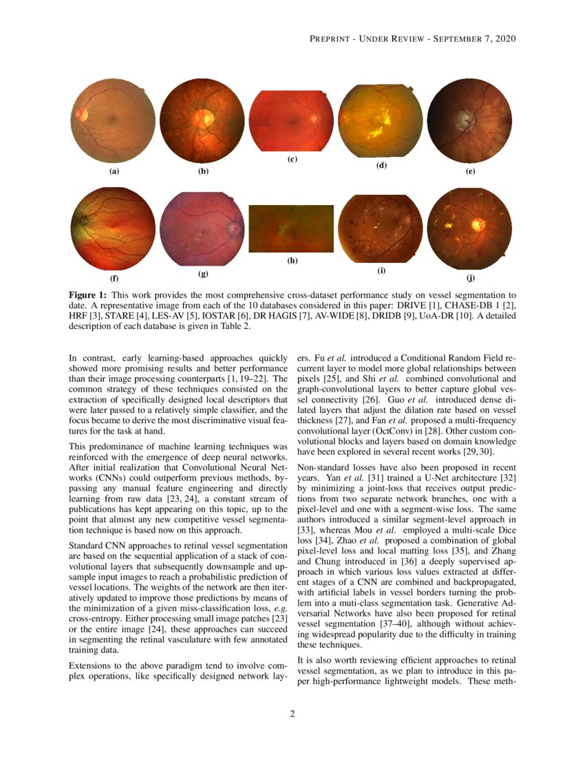 The Little W-Net That Could: State-of-the-Art Retinal Vessel ...