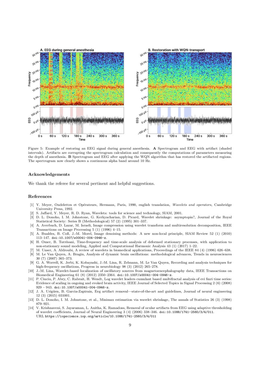 The WQN algorithm to adaptively correct artifacts in the EEG signal | DeepAI