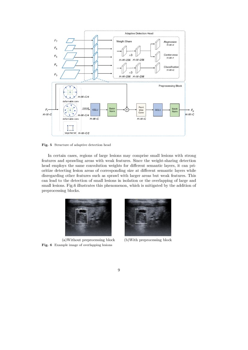 Thinking Twice: Clinical-Inspired Thyroid Ultrasound Lesion Detection Based on Feature Feedback ...