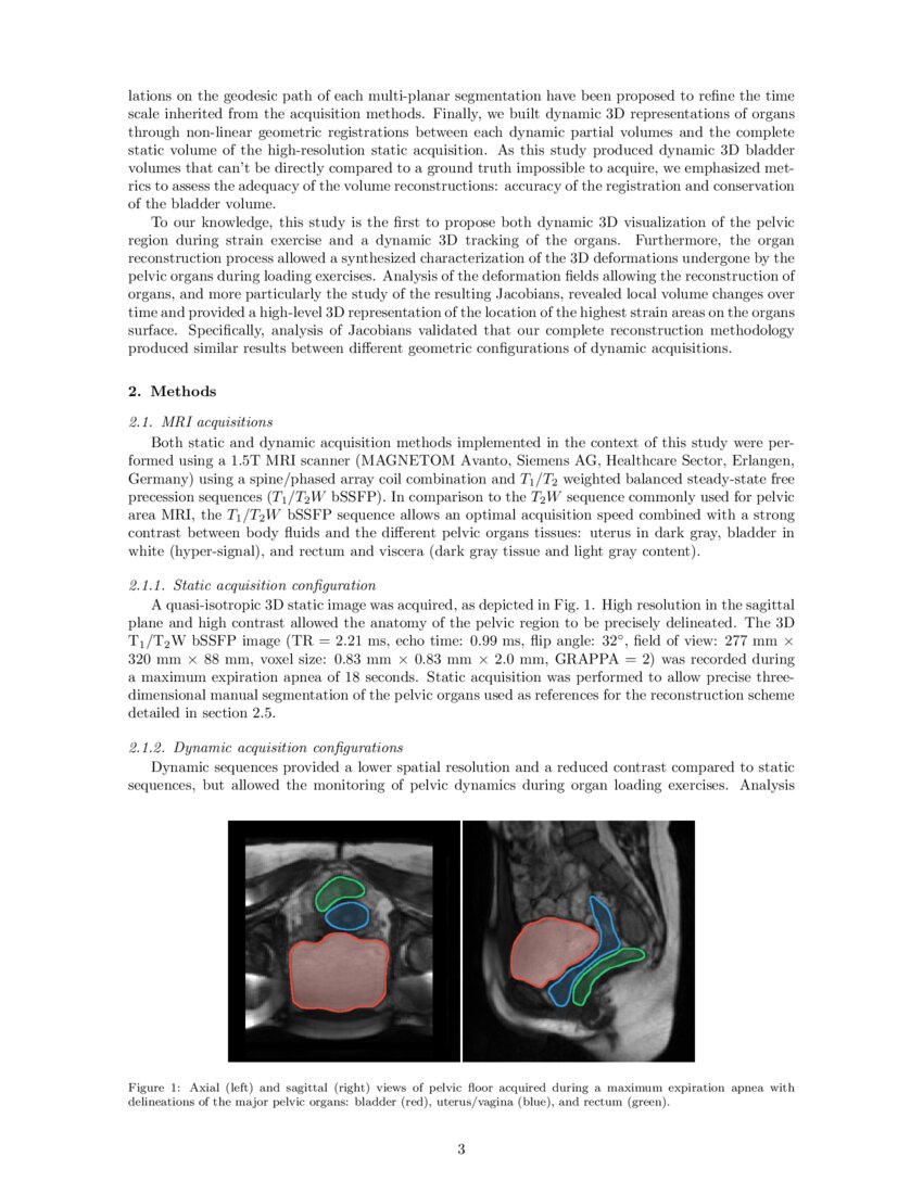 Three-dimensional reconstruction and characterization of bladder ...